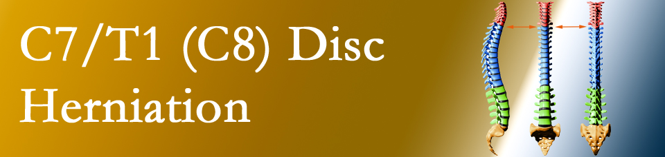 Chiropractic Care for C8 Disc Herniations | Medical Spine and Sports ...